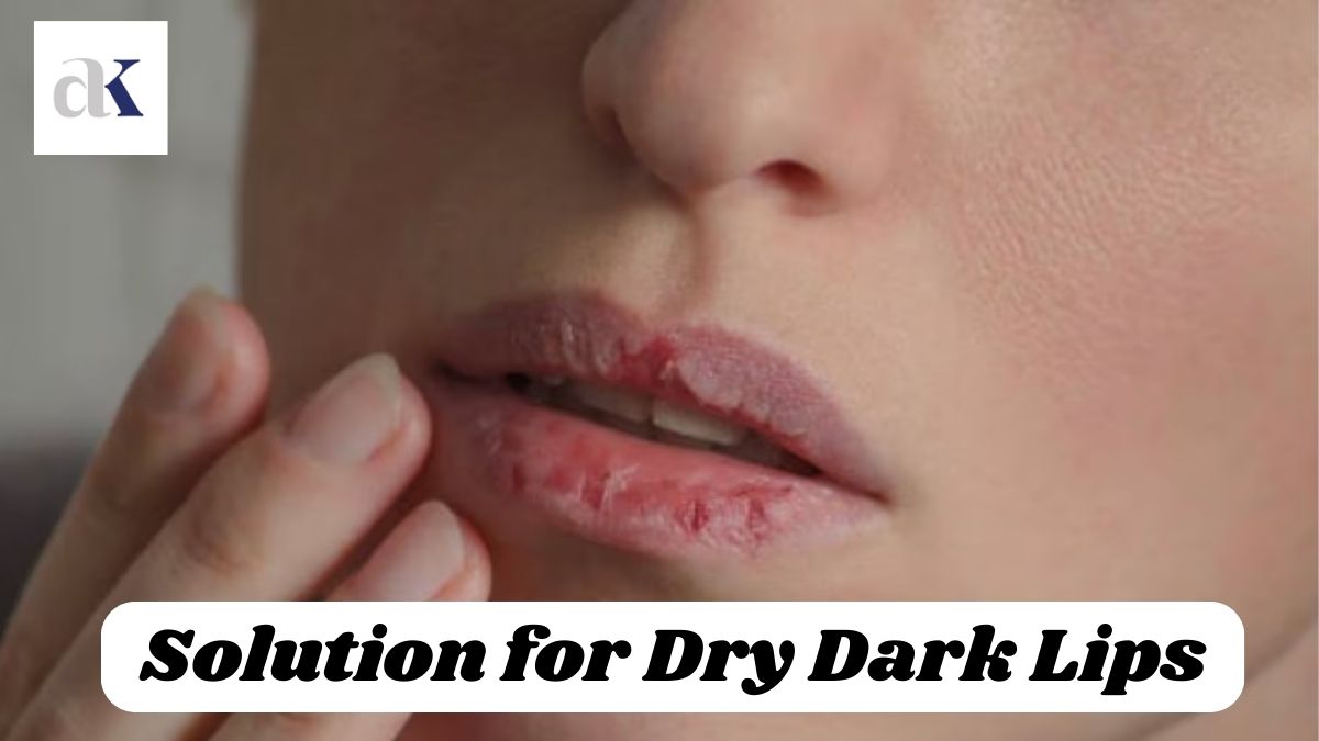 Solution for Dry Dark Lips with Best Dermatologist in Indore